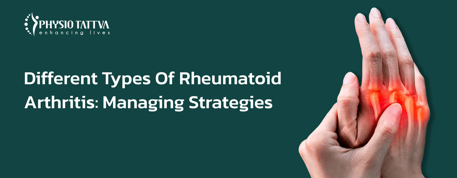 Understanding the Different Types of Rheumatoid Arthritis