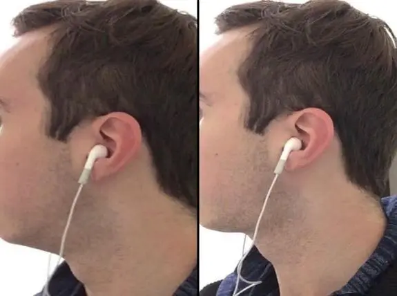 Mewing Before & After: 122+ Progress Photos (Male & Female Transformations)