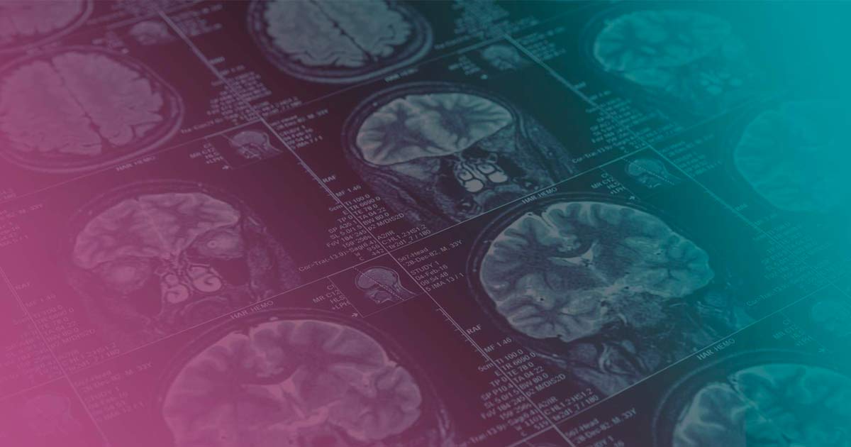 Brain Injury Overview