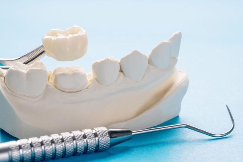 Dealing with a Loose Implant Crown: Your Complete Guide