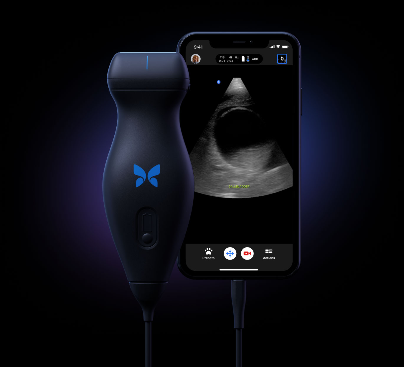 An expert-led tutorial of veterinary FAST scanning