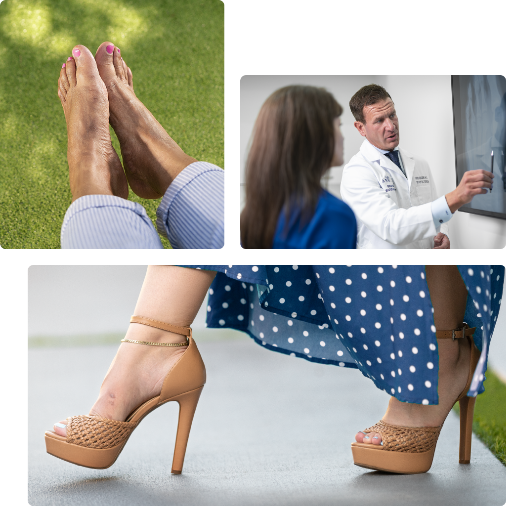 Minimally Invasive Bunion Surgery | Arthrex Bunionectomy