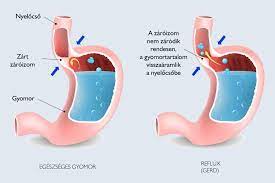 Professional Gasztroenterológiai Centrum