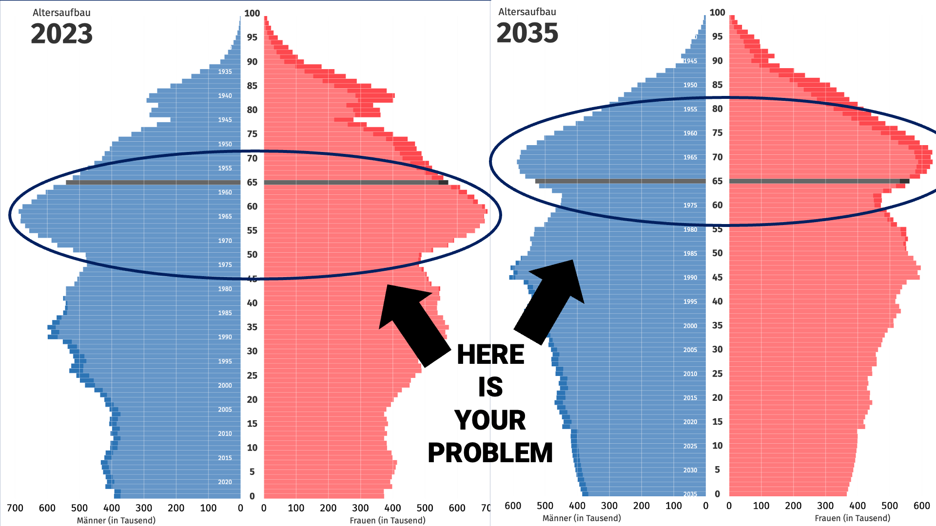 Tackling the "Baby Boomer Belly": Preparing for a Demographic Shift