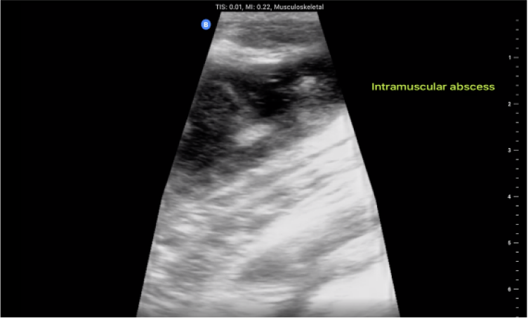 Integrating POCUS into Veterinary Care