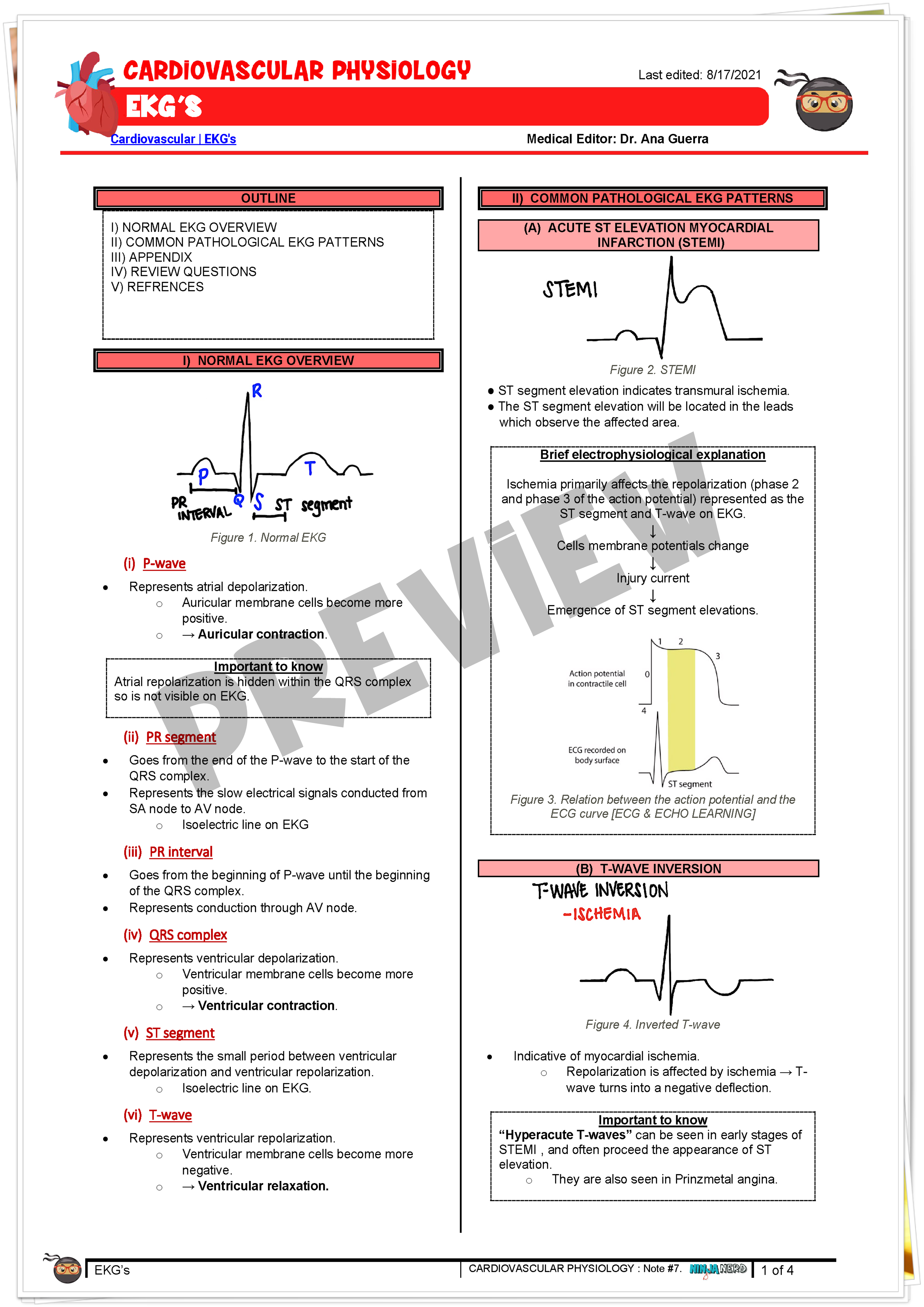 Cardiovascular | EKG's - Notes - NinjaNerd Medicine