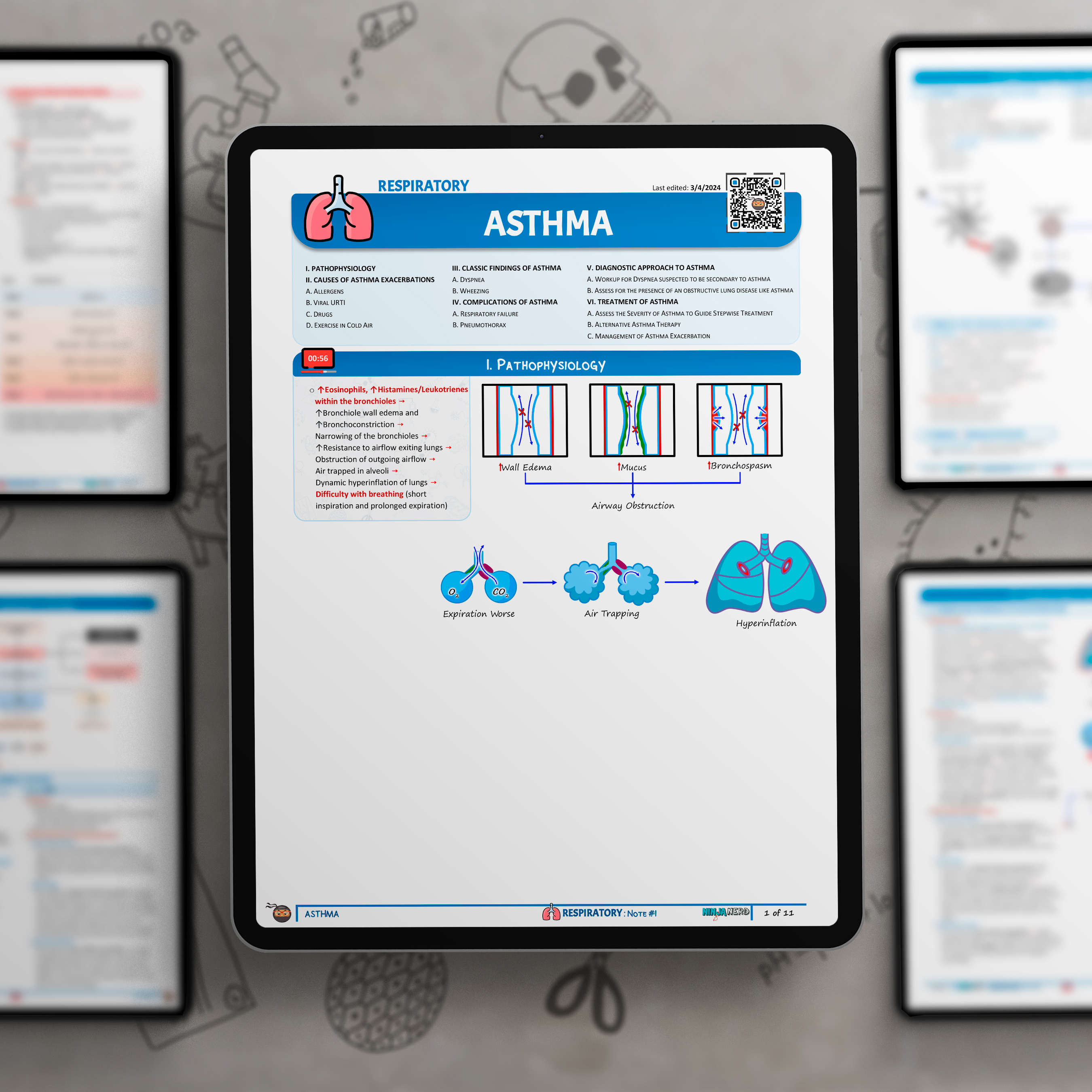 Asthma - Notes - NinjaNerd Medicine