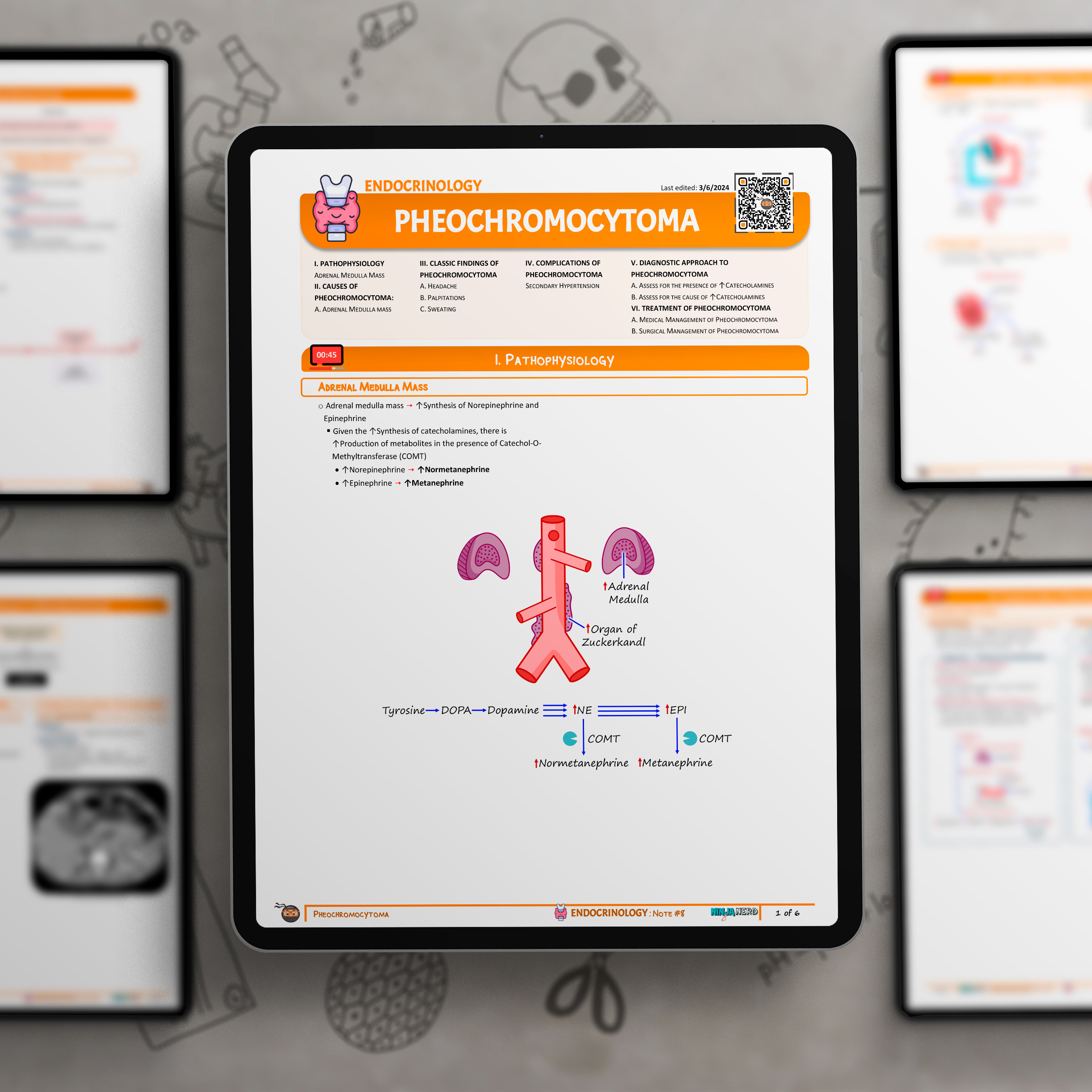 Pheochromocytoma - Notes - NinjaNerd Medicine
