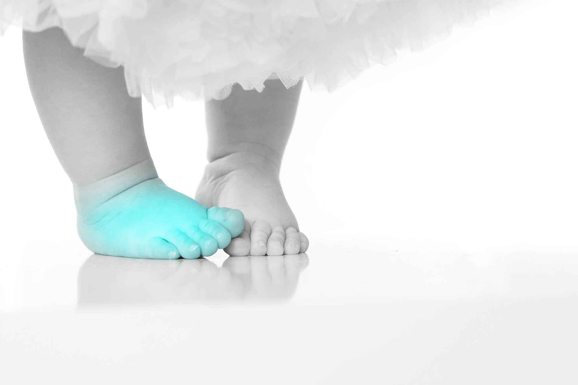 In Toe/Out Toe Gait | Mississauga Foot Clinic
