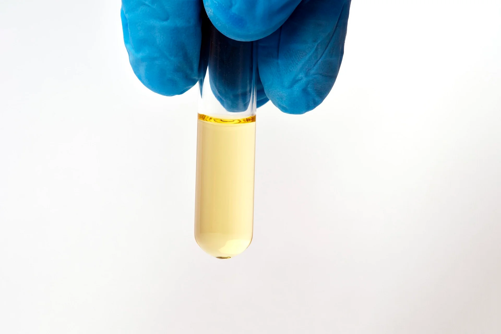 Metabolomics Testing: A Powerful Tool For Precision Nutrition | | iTHRIVE