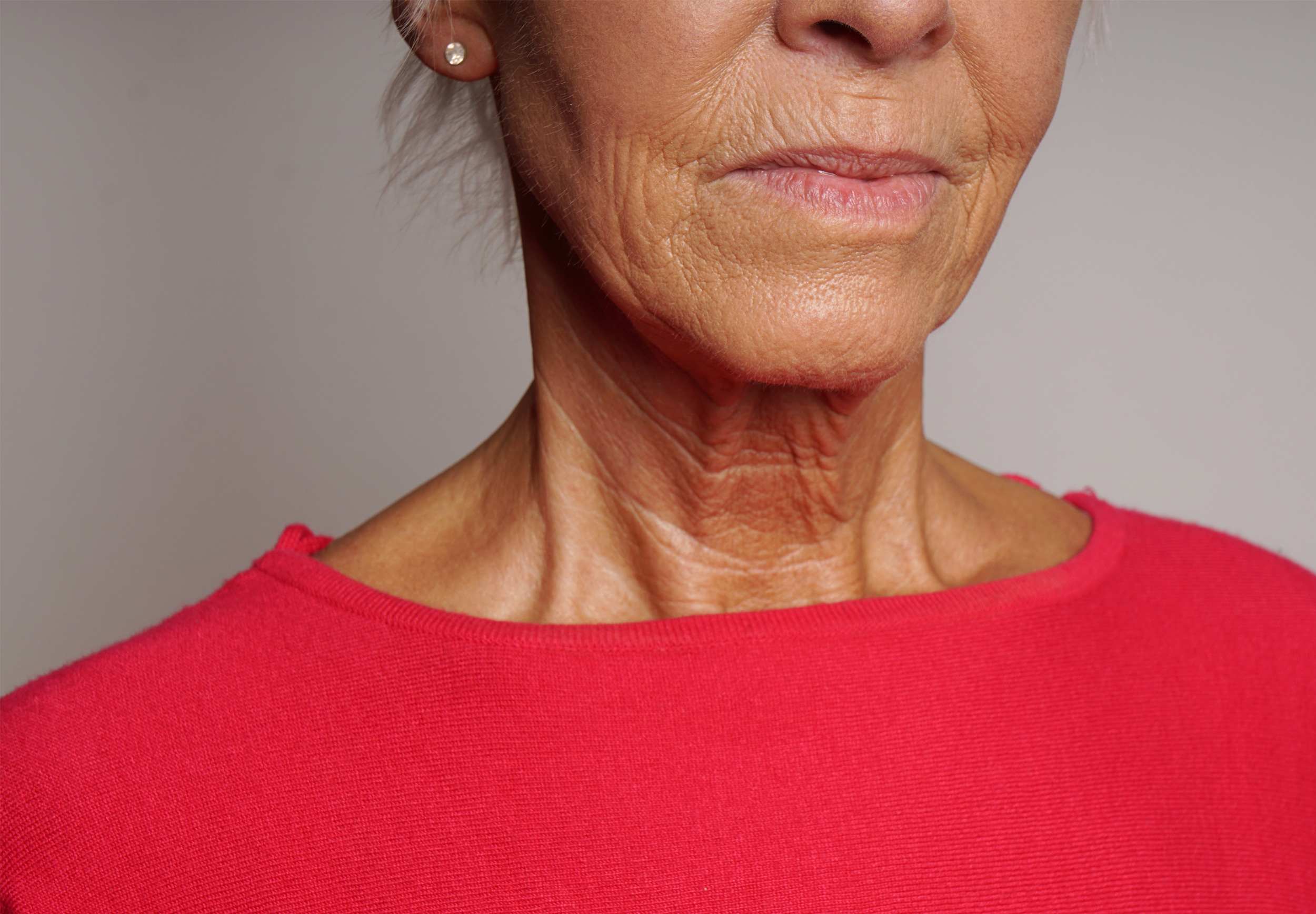 Ageing neck | Alisha Louise Aesthetics | Skelmersdale