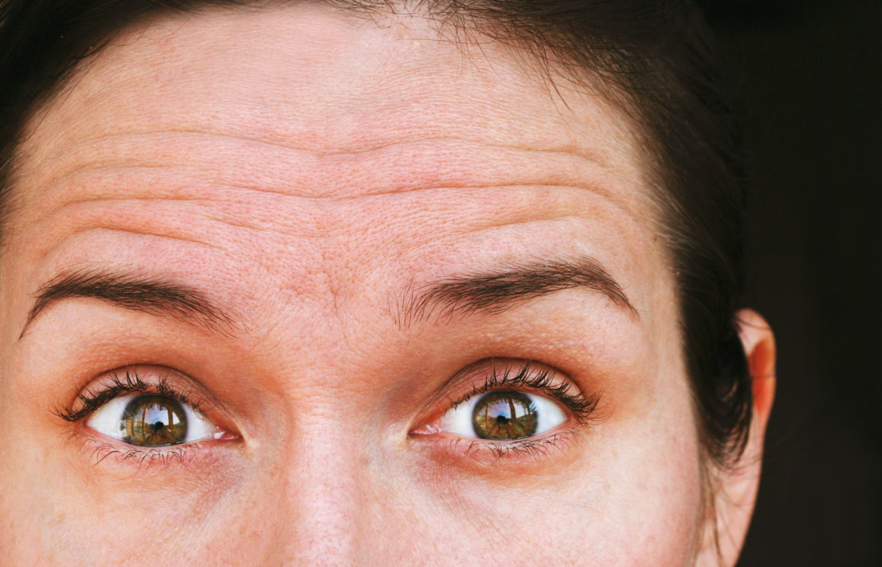 Skin Aging & Wrinkles | Treasure Valley Dermatology | Dr. Dustin Portela