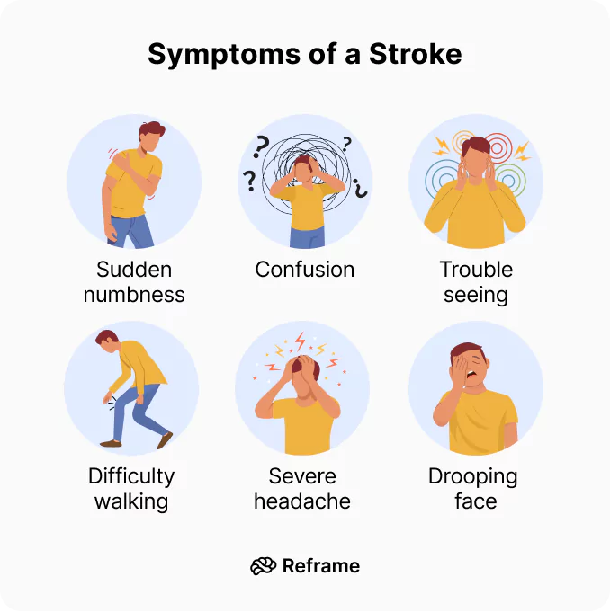 Can Drinking Too Much Alcohol Cause a Stroke?