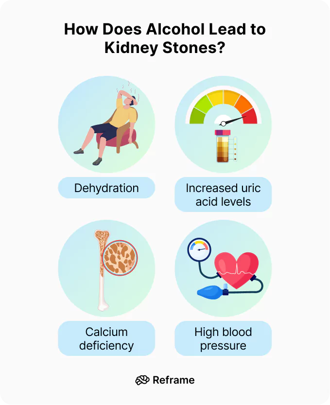 Does Alcohol Cause Kidney Stones? The Risks Factors