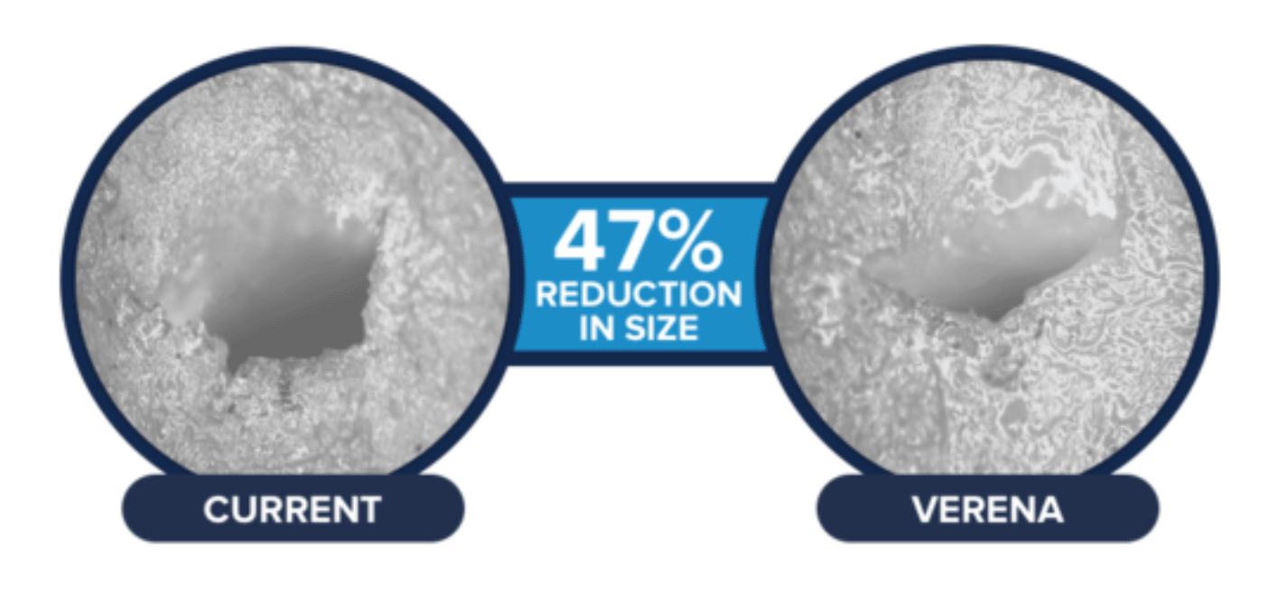 SimpleCAP Dental Safety Needle, Yellow Capsule, 27ga Long | Verena Solutions