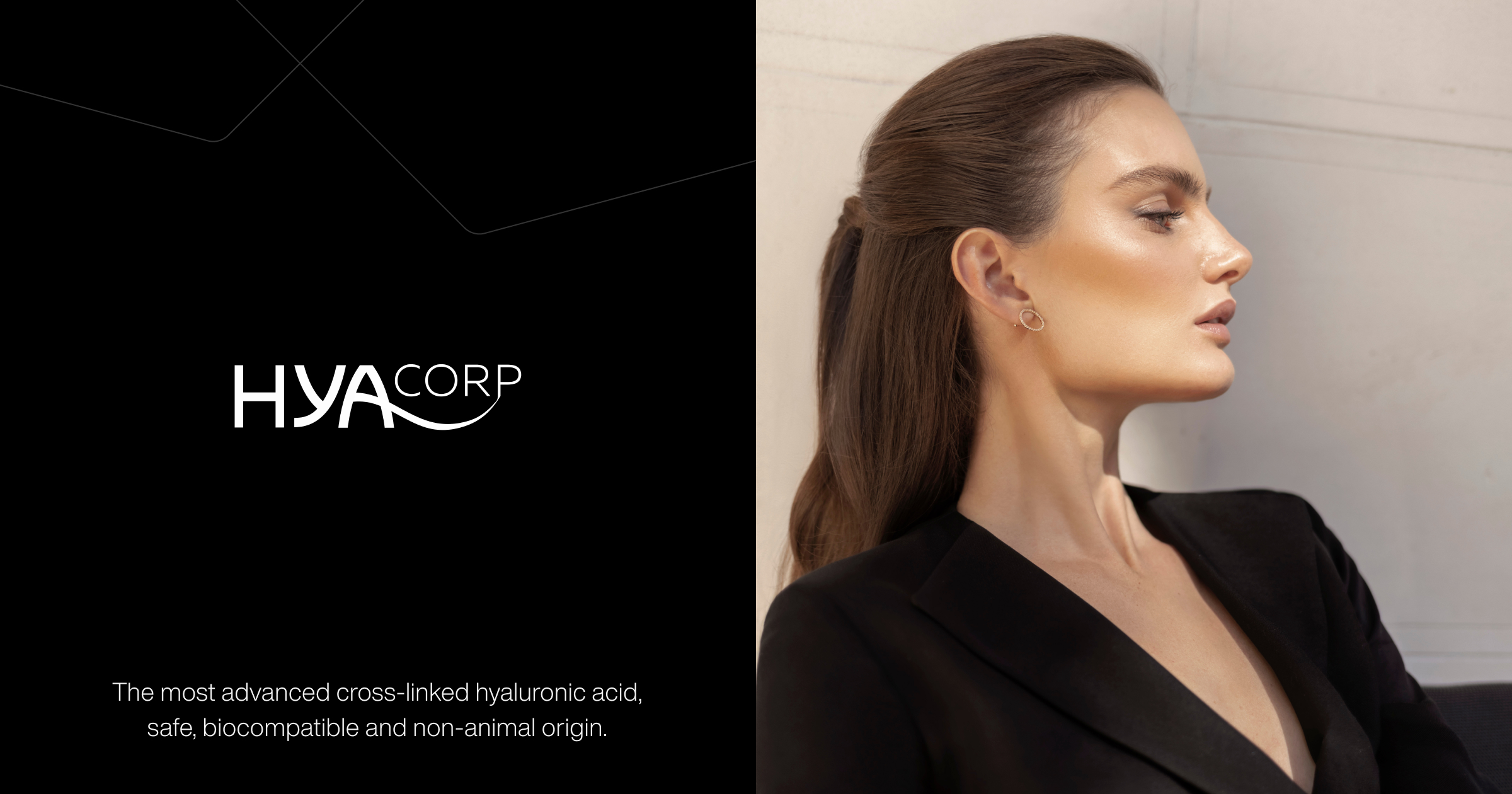 Technology behind HYAcorp | Crosslinked Hyaluronic Acid Fillers