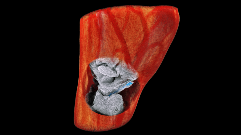 Mars Bioimaging: revolutionising medical imaging