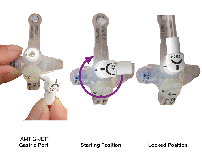 G-JET® | Enteral Feeding