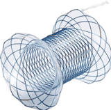 Pseudo Cyst Stent | Gastroenterology