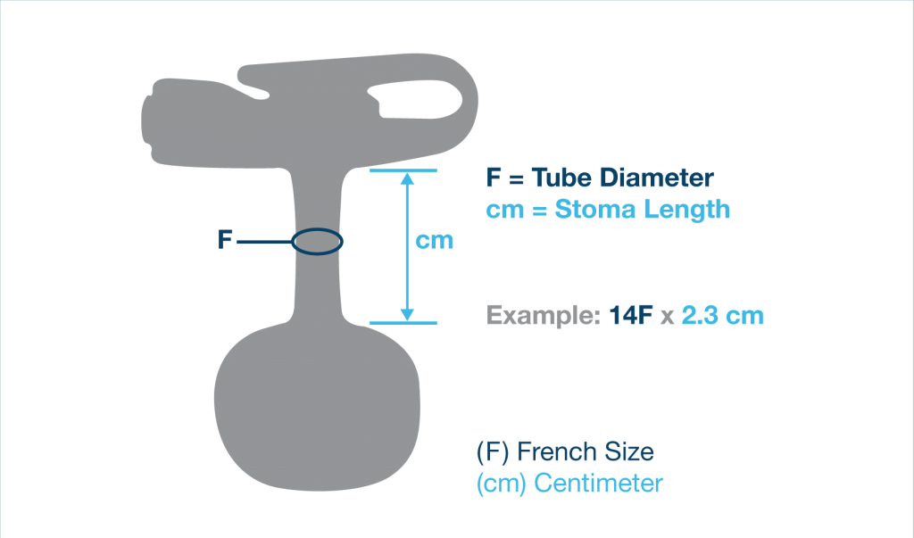 MiniONE® Balloon Button | Enteral Feeding