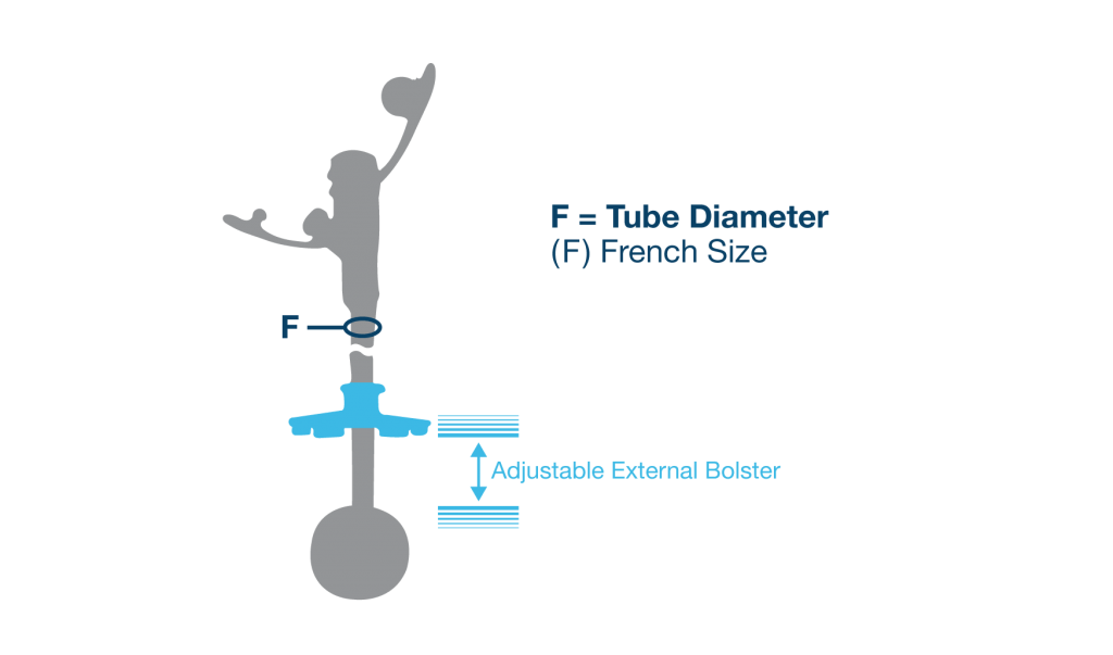 Balloon G-Tube | Enteral Feeding