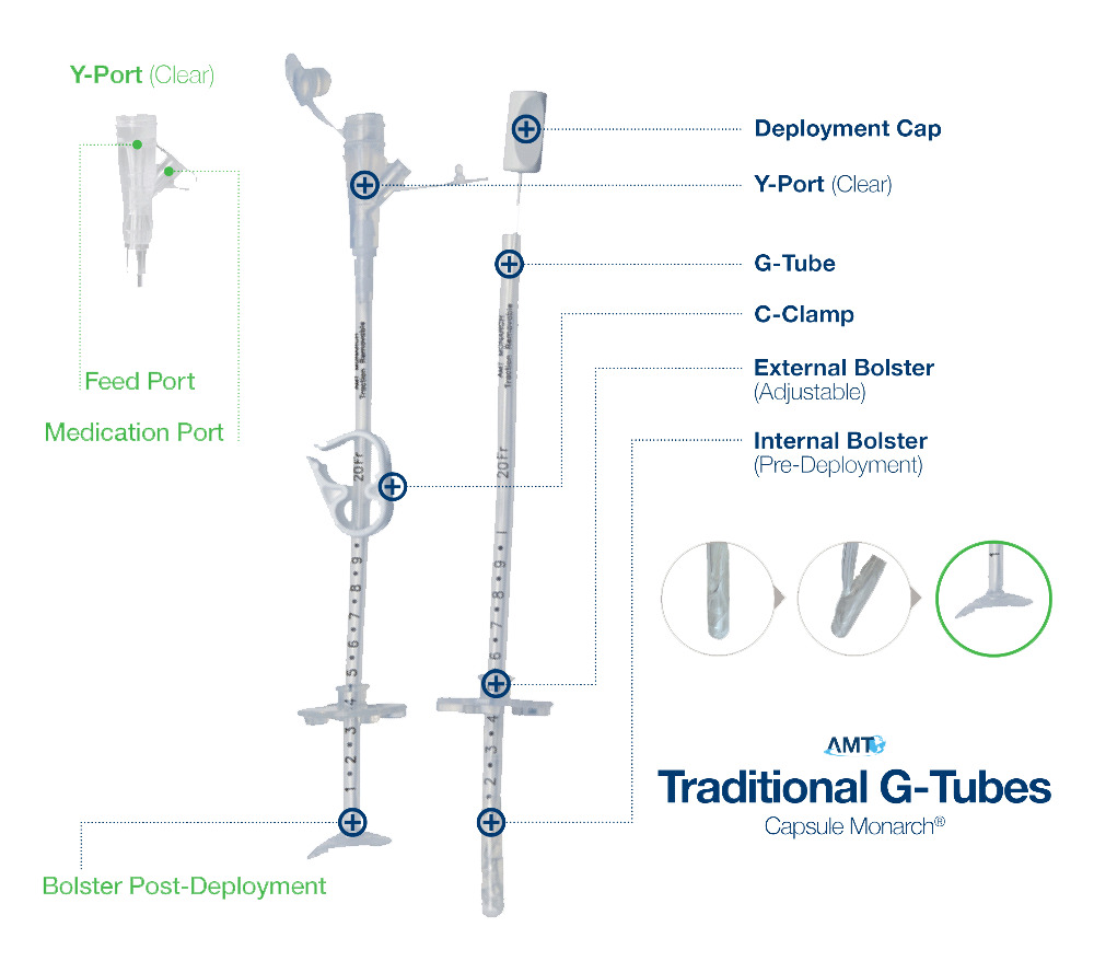 Capsule Monarch® G-Tube | Enteral Feeding