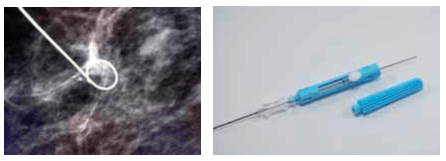 Biopsy Needles | Oncology