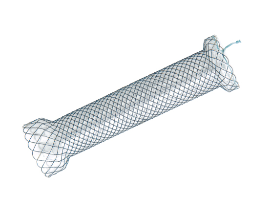 Esophageal Stents | Gastroenterology