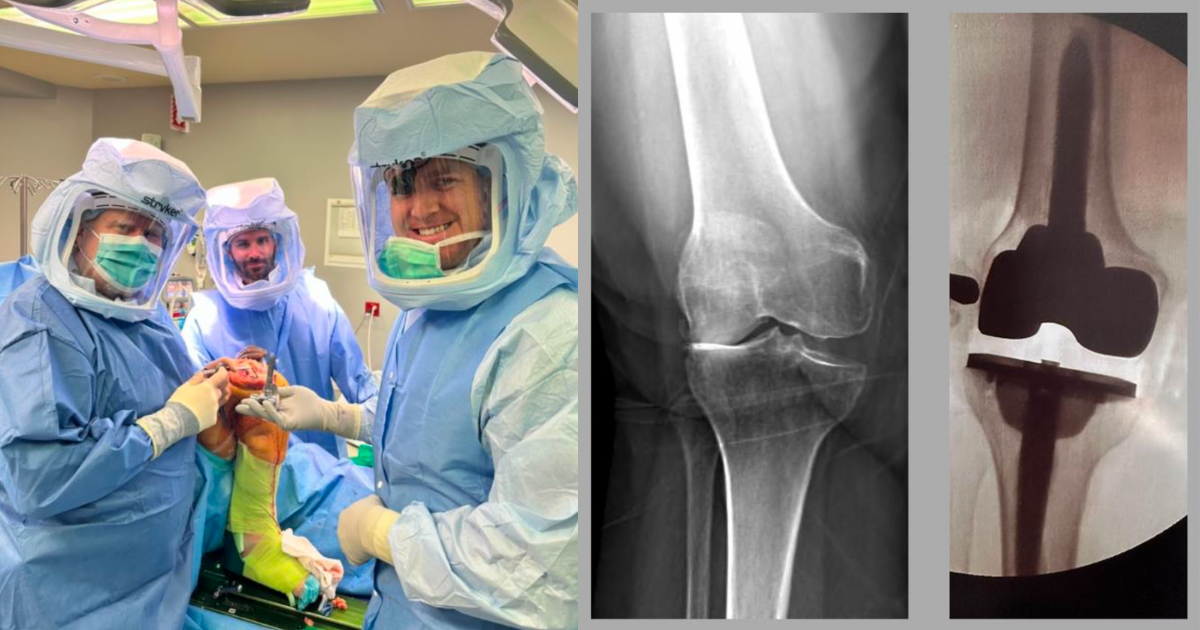 Total Joint Orthopedics Receives FDA Clearance on the Klassic® Knee ...