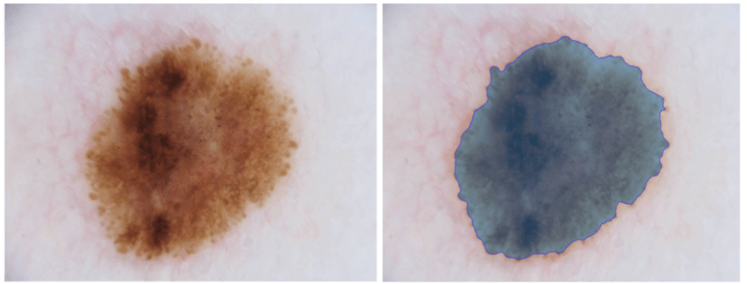 Optimizing Data Annotation: Understanding the Process Behind the iToBoS ...