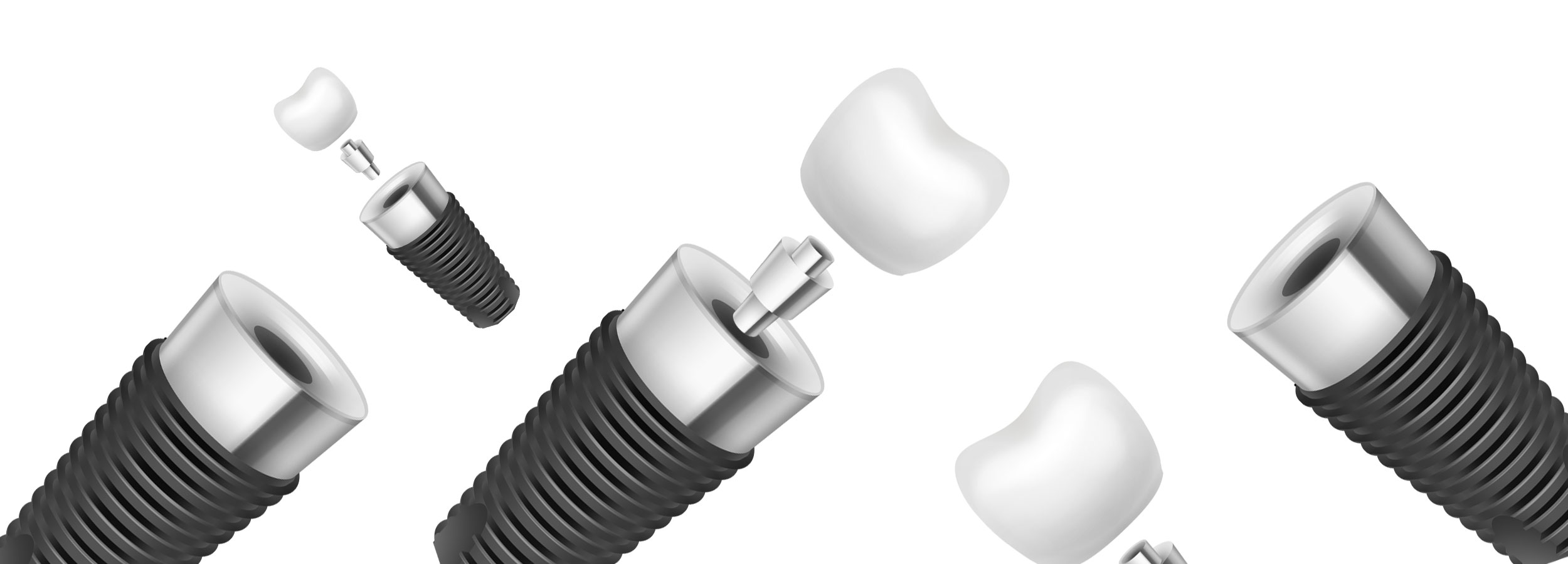 TX Plan - Implant Planning by ITX Pros