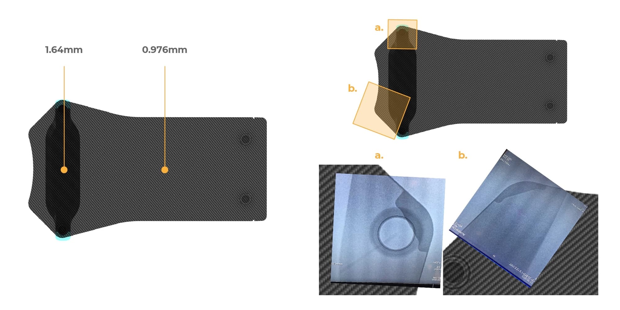 Retrograde IR Platform - Adept Medical