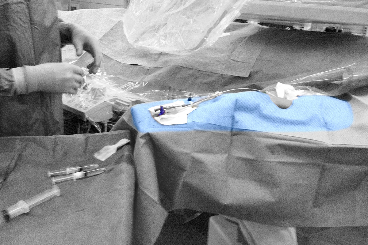 IR System - Adept Medical