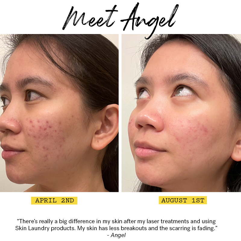 Results - Skin Laundry