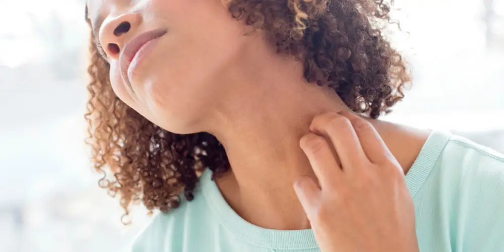 Insider Reviews: How to identify common bug bites or stings and treat ...