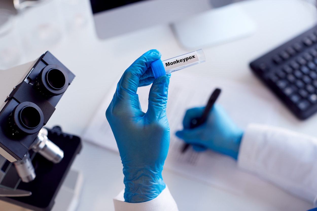 Monkeypox: An Overview and Resources - Trusted Health
