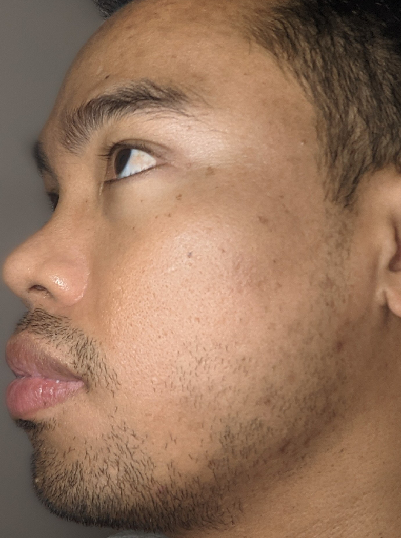 Results - Skin Laundry