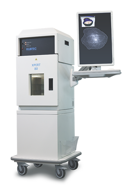 The XPERT Systems | Specimen Radiography | KUBTEC