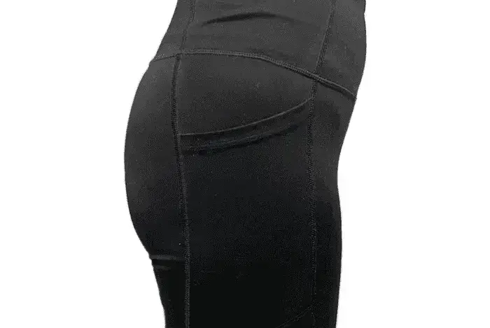 Buttock Augmentation: Get a Fuller, Sculpted Butt