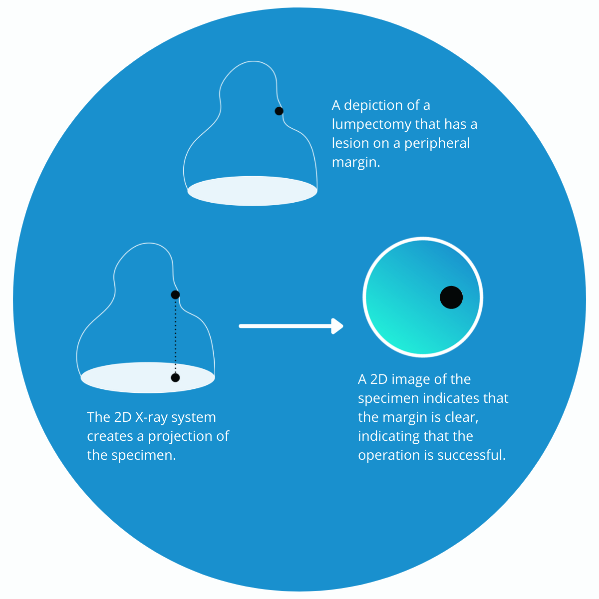 Guide to Understanding Surgical Margins | KUBTEC