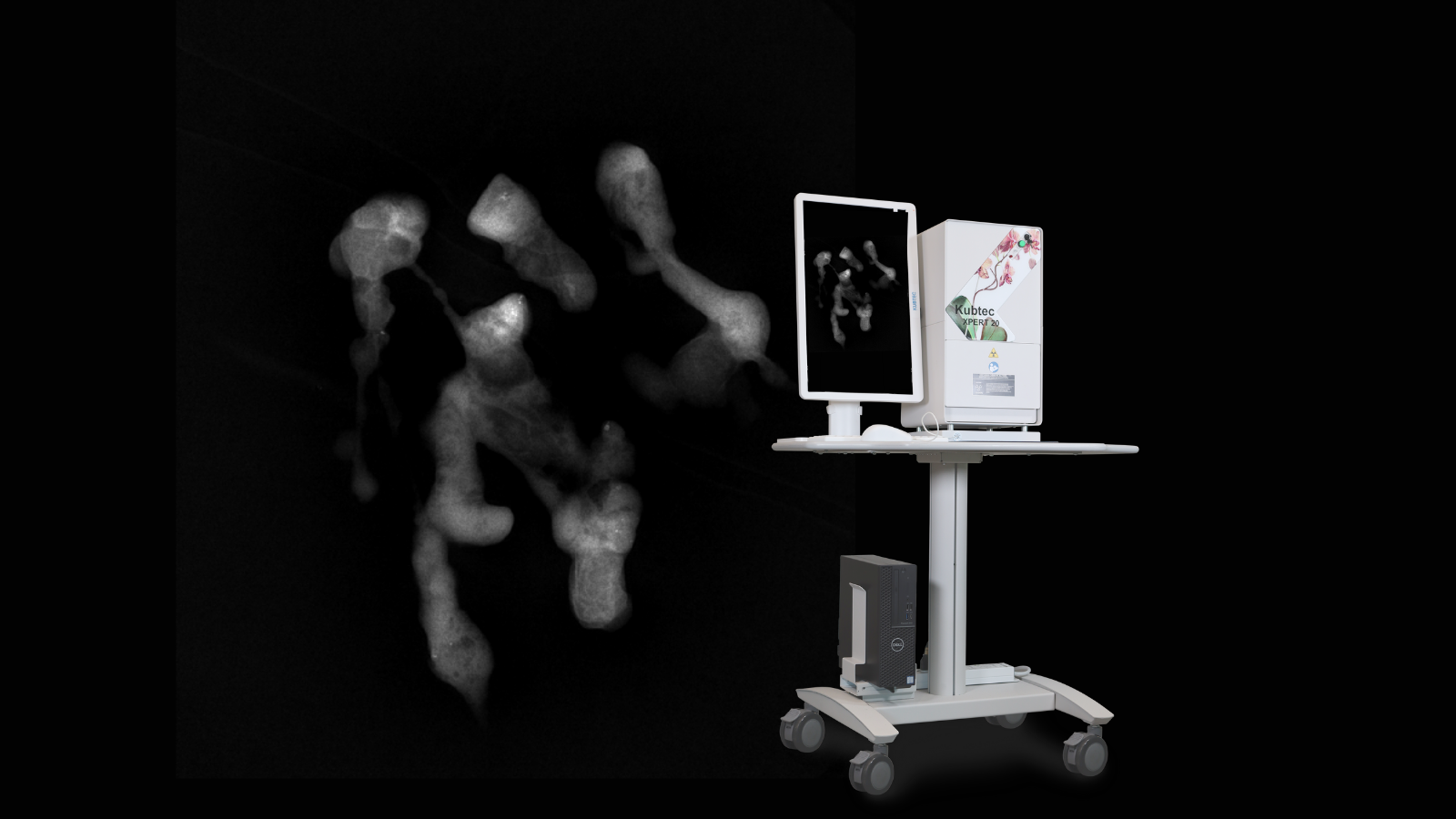 The XPERT® 20 Specimen Radiography System | KUBTEC