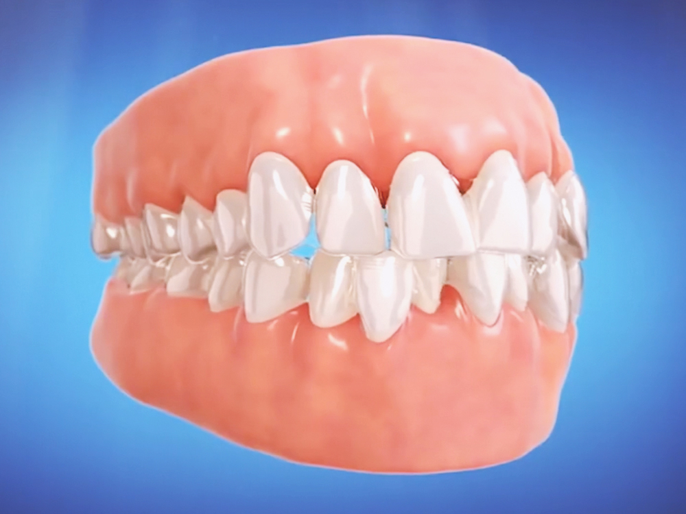 Creating Smiles & Changing Lives | Idaho Orthodontics