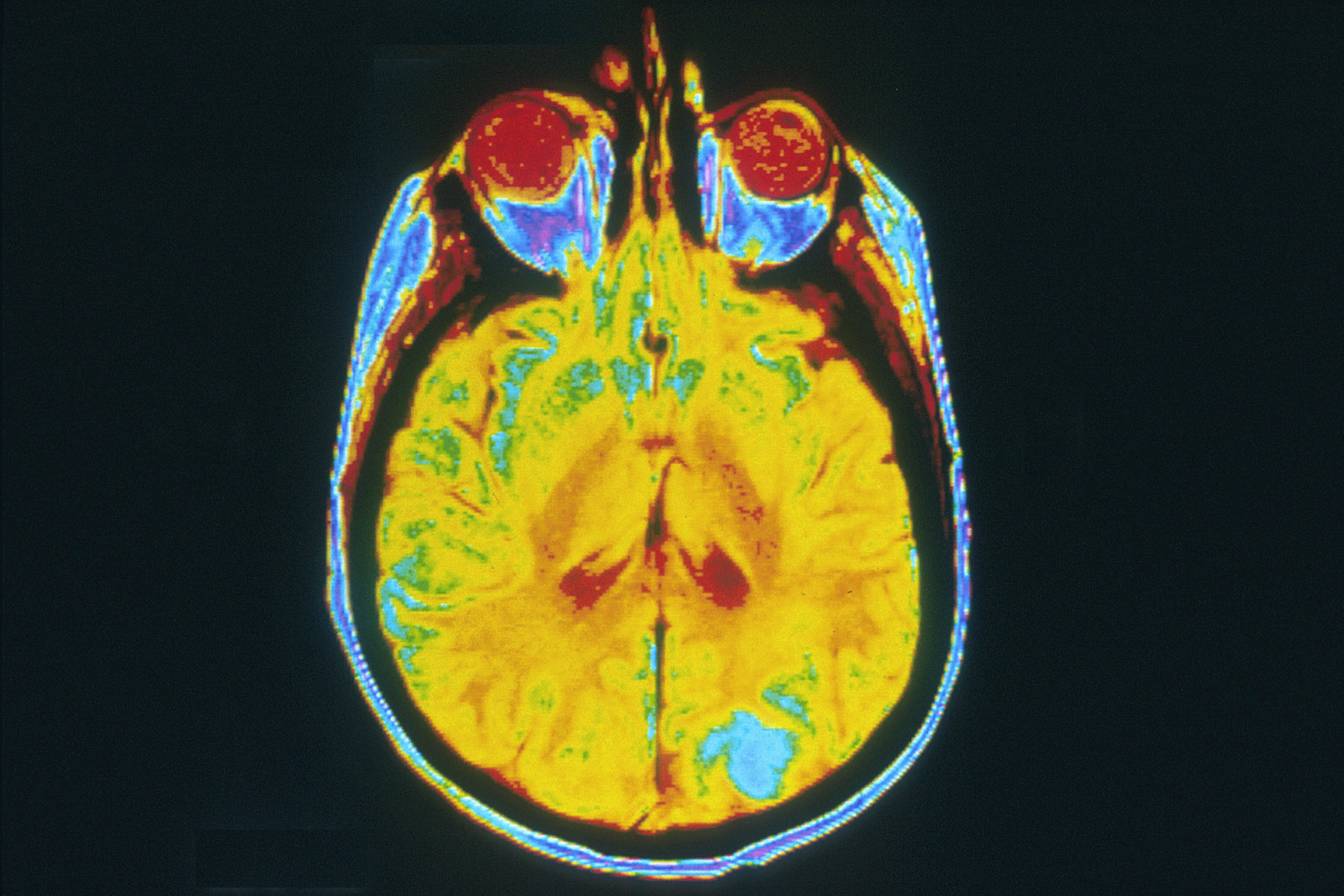 Abraham Gutman Speaks at National Cancer Institute Medical Imaging Workshop