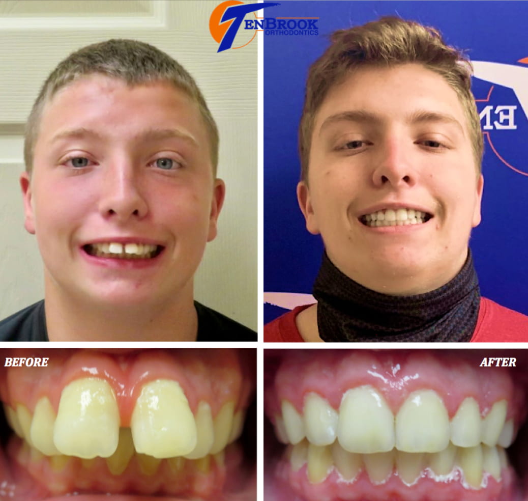 New Year, New Smile: Why 2024 is the Perfect Time to Start Children’s ...