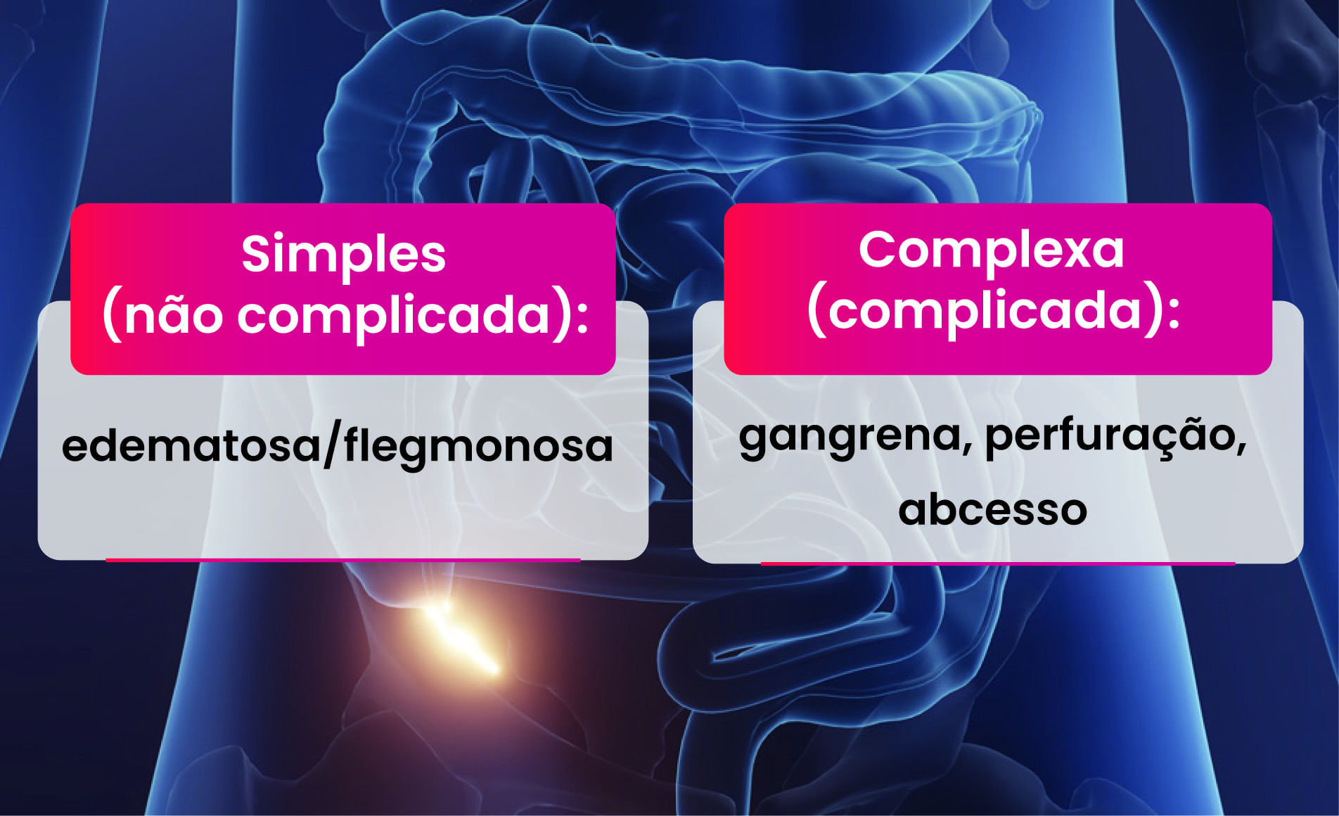 Tudo sobre Apendicite aguda para você arrasar nas provas