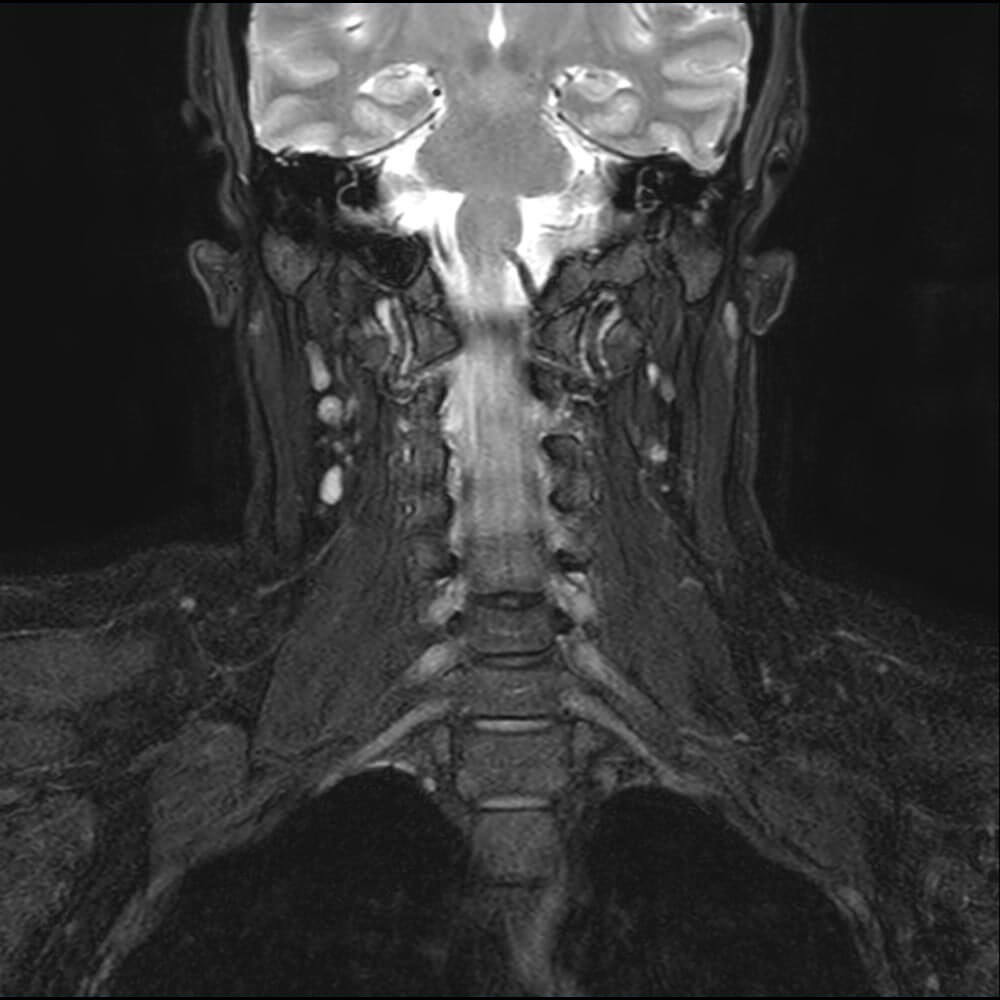 radiologiehoch3 Hals