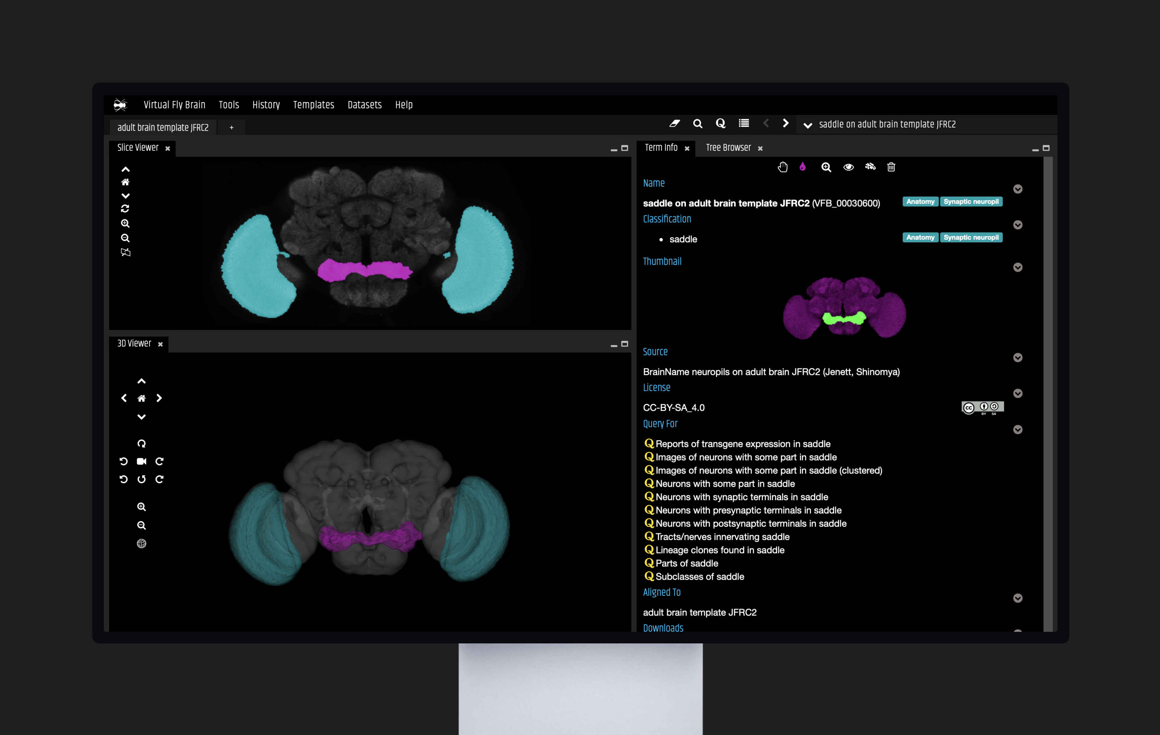 Virtual Fly Brain | Case Study | MetaCell