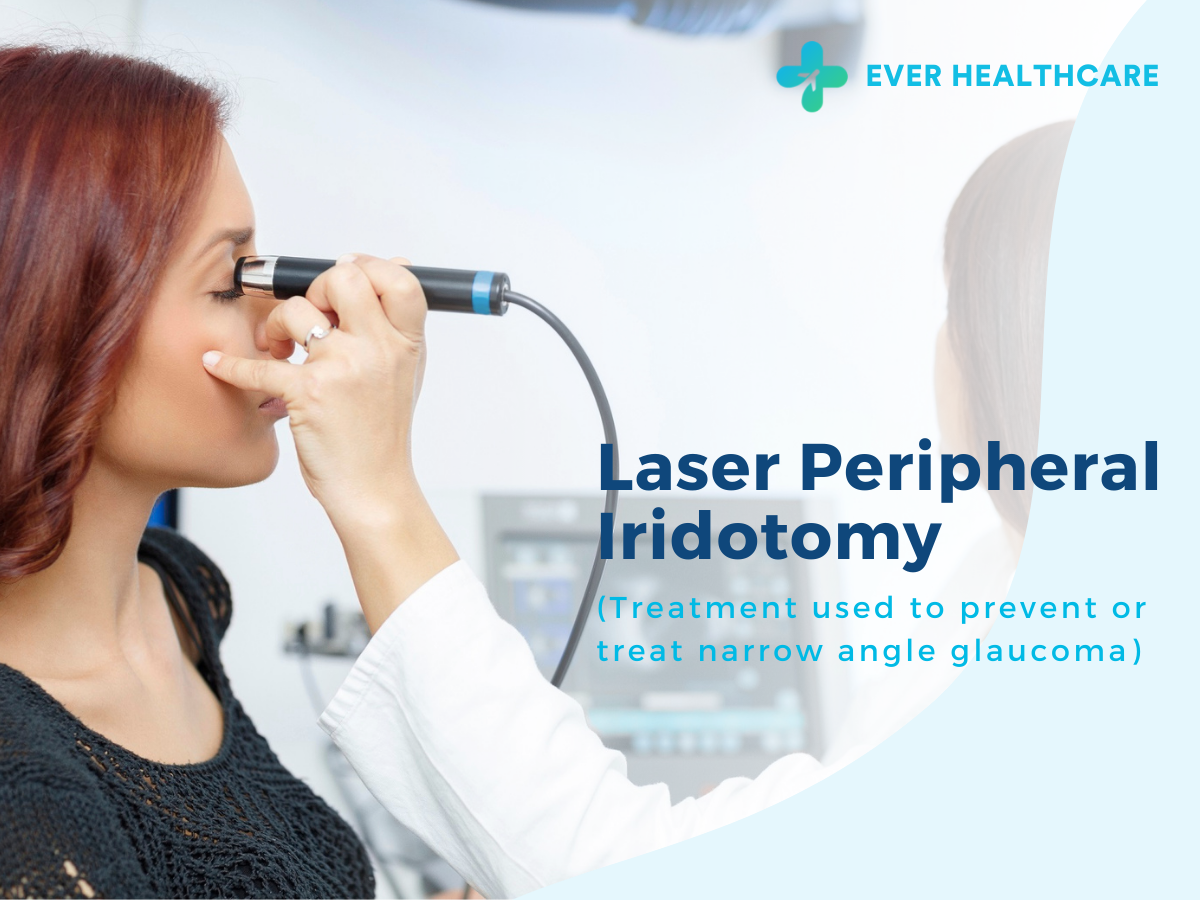 Laser Iridotomy Alternatives at Karla Trent blog