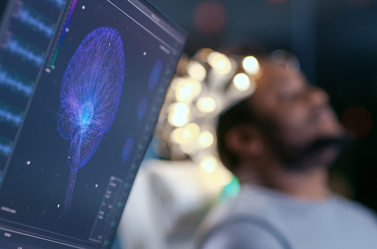 The Neuroscience of Stress • BetterManager