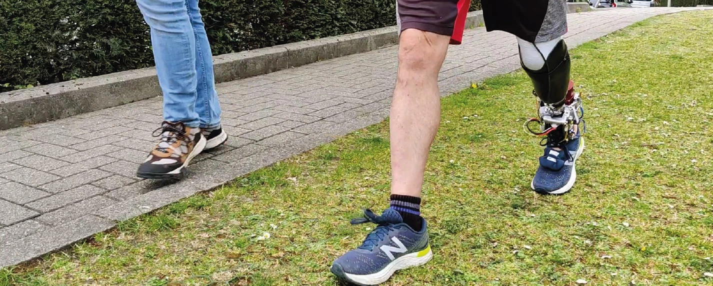 3 Innovations in Bionic Prosthetics: AI and biomechanics | Axiles Bionics